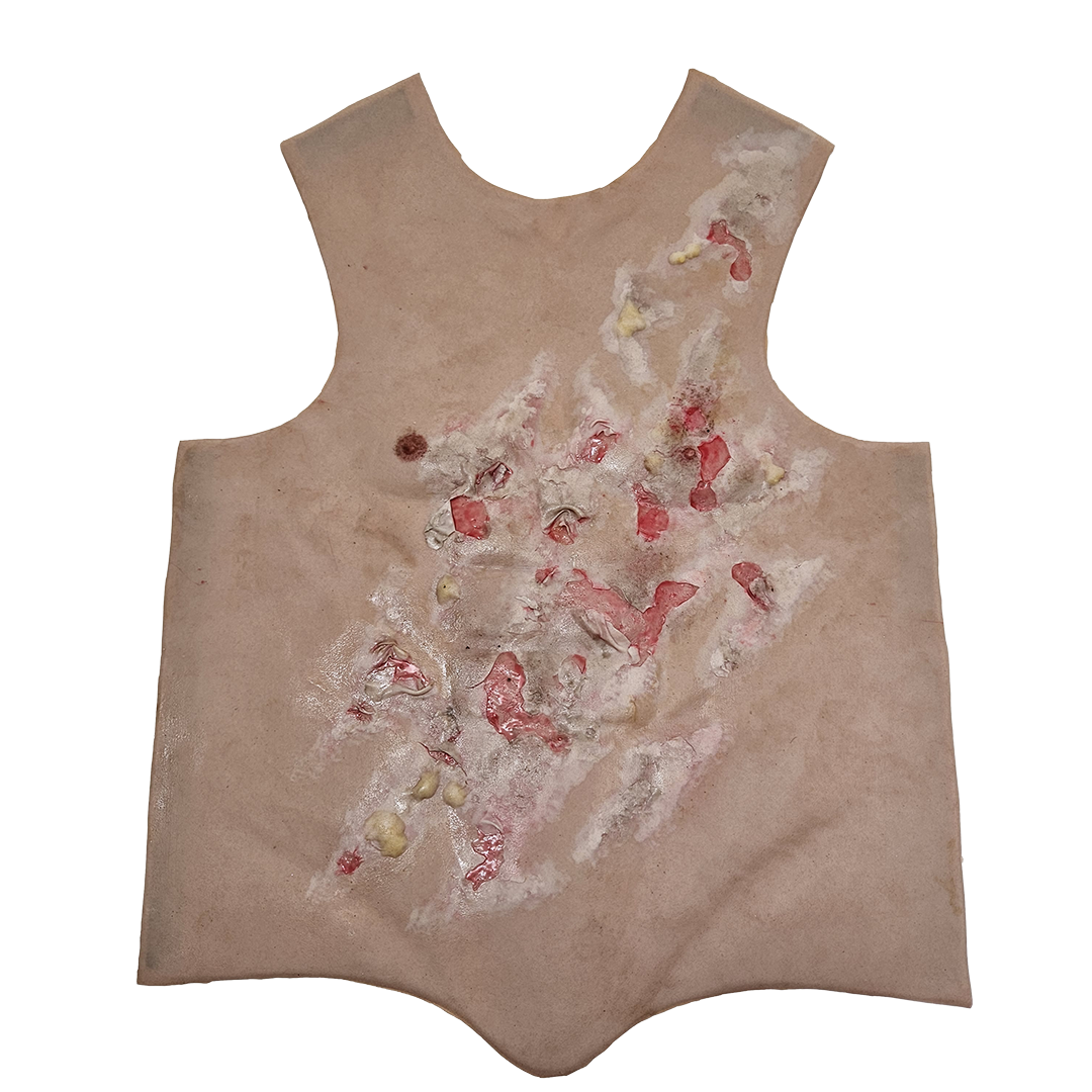 MB810 Burn Patient - MedicFX